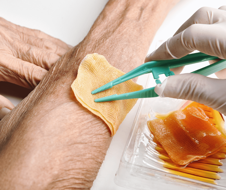 Prevenzione delle lesioni da pressione e delle skin tears